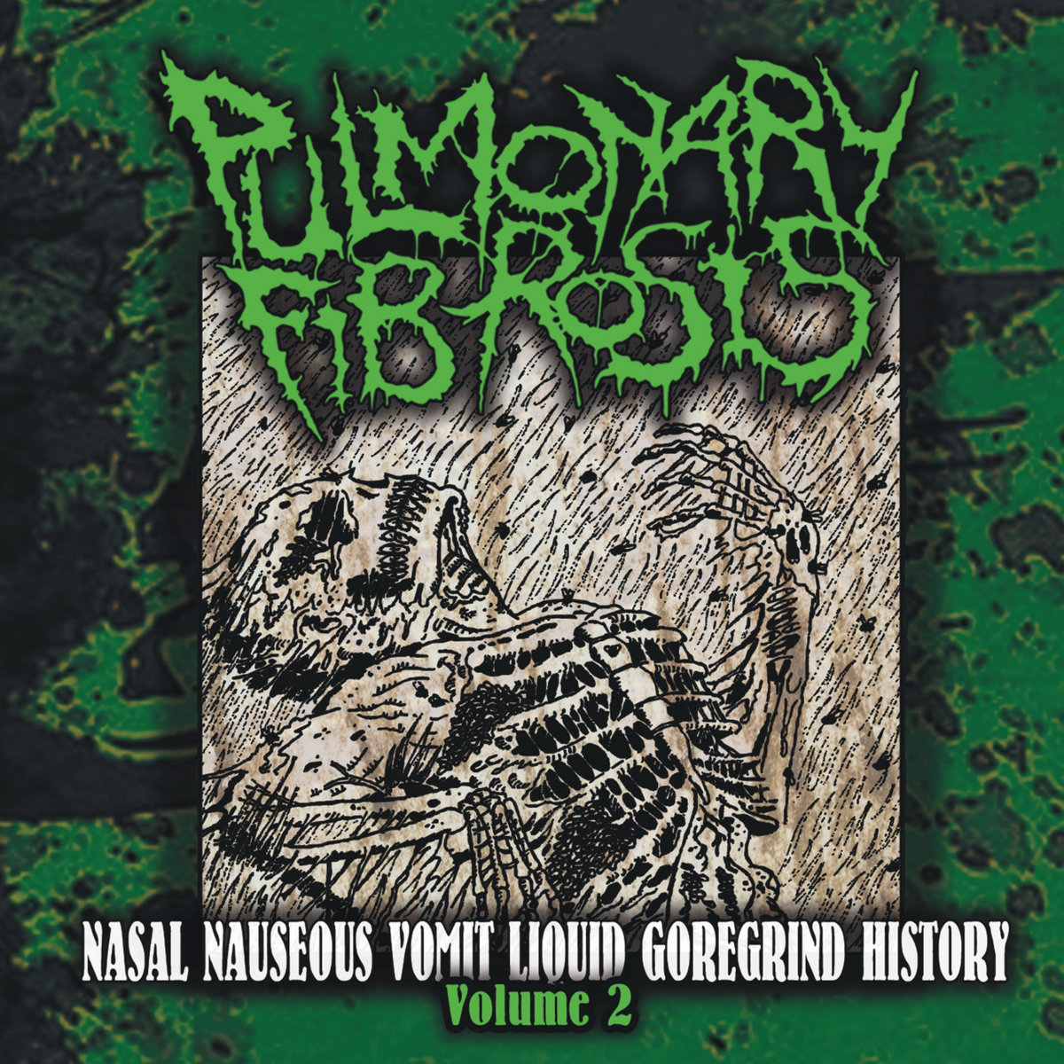 Pulmonary Fibrosis – Nasal Nauseous Vomit Liquid Goregrind History ...